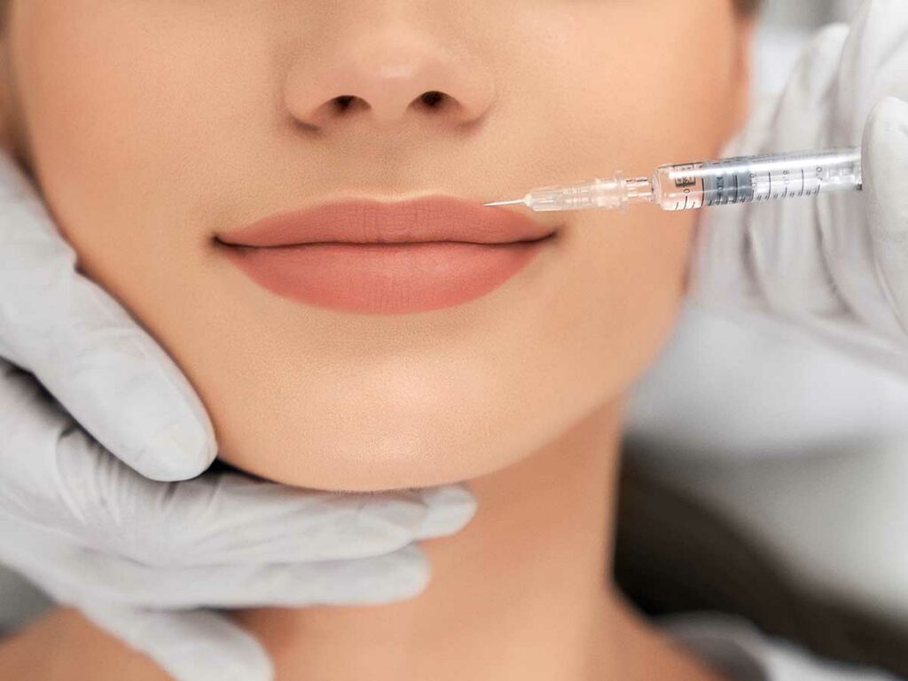 Filler all’acido ialuronico per Labbra: ecco tutto quello che devi sapere ⋆
